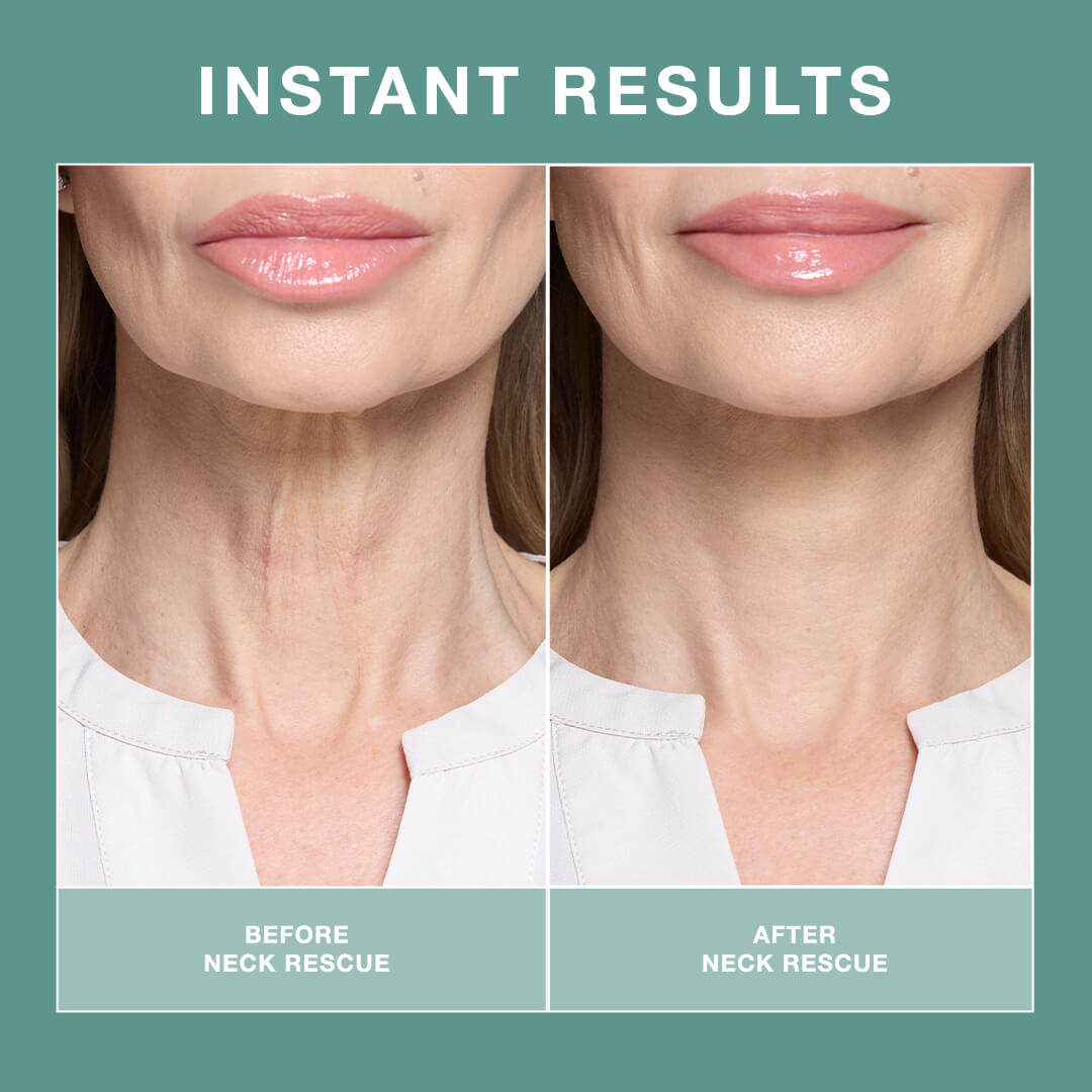 Neck Rescue | Neck Lift Tightening Strip | Contours Rx