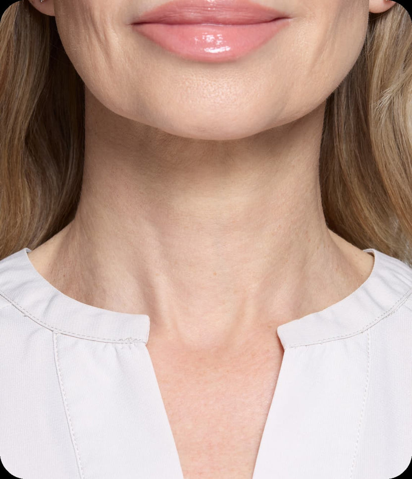 WHY CHOOSE CONTOURS RX? – Contours Rx