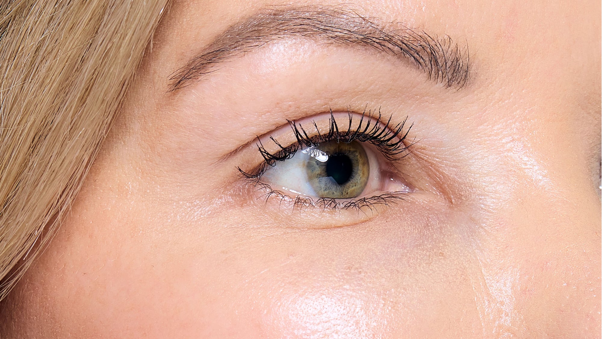 Before & After Results | See the Difference | Contours Rx