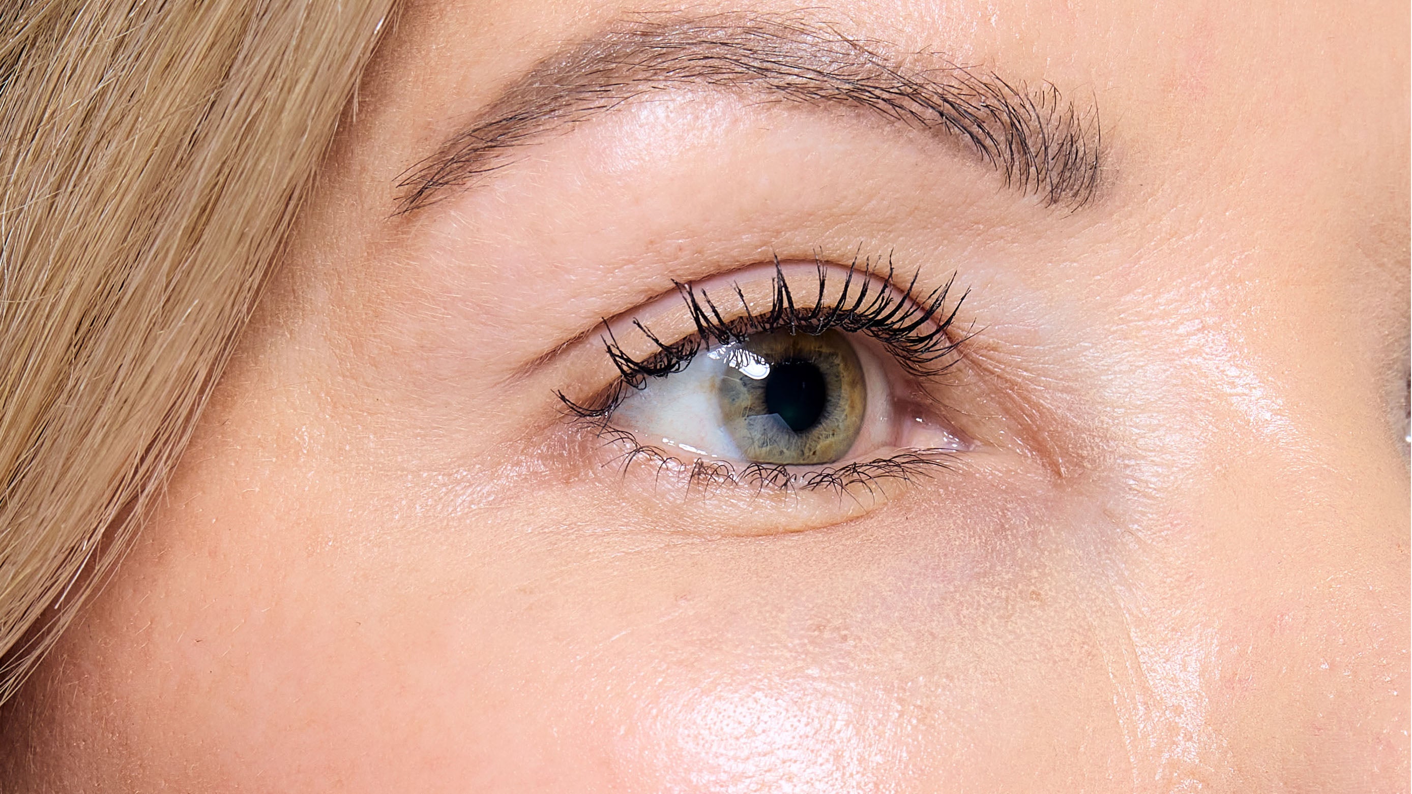 Before & After Results | See the Difference | Contours Rx