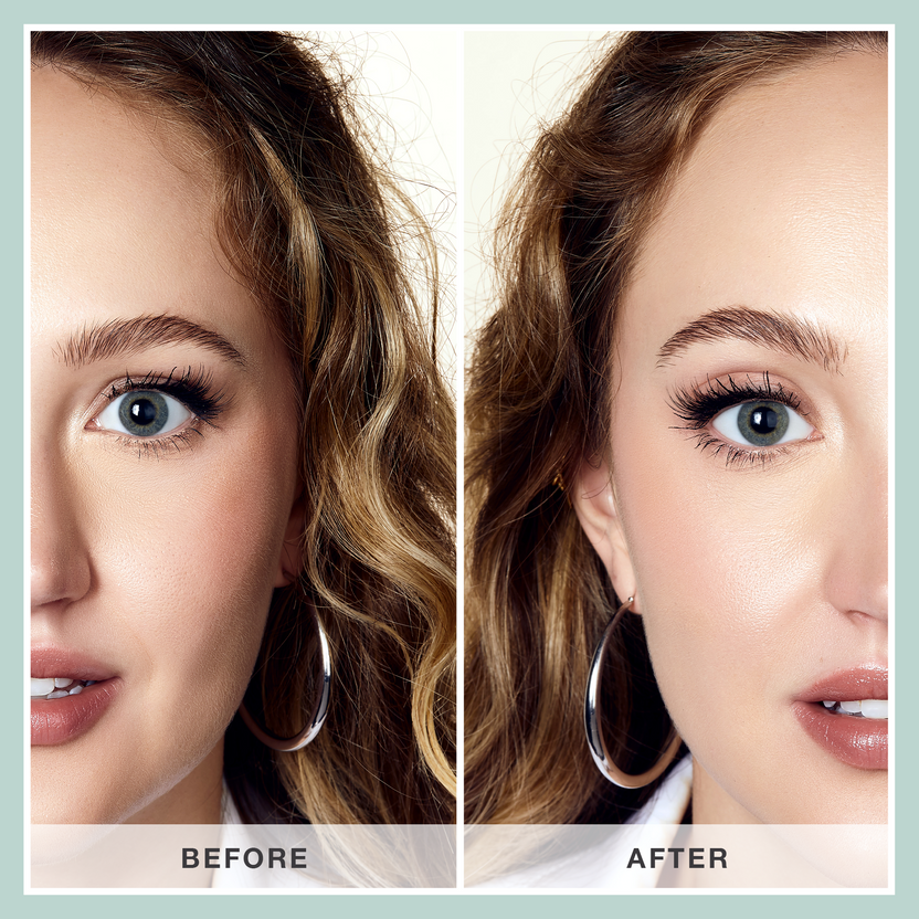 Before & After Results | See the Difference | Contours Rx