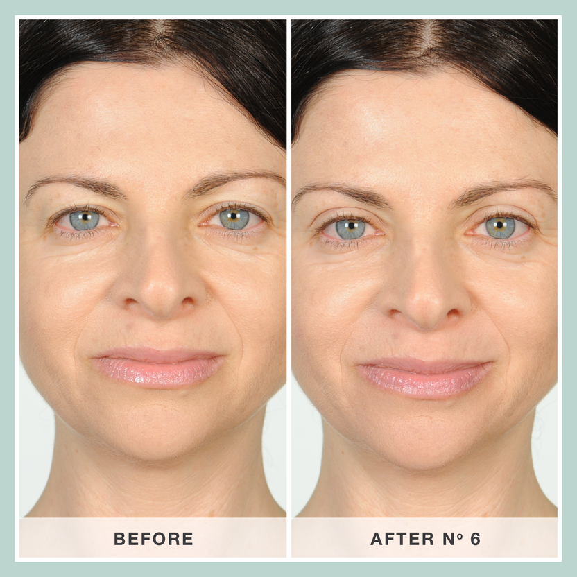 Before & After Results | See the Difference | Contours Rx