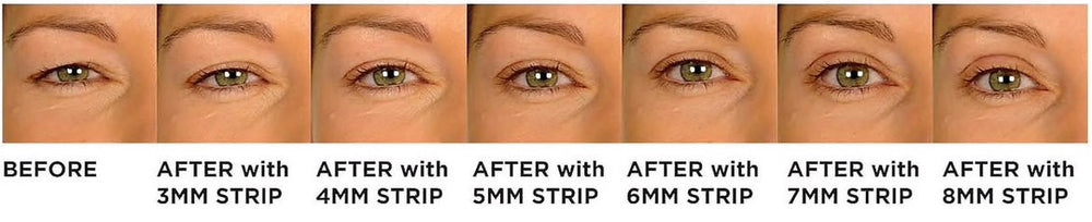 Before & After – Contours Rx