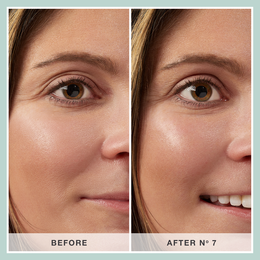 Before & After Results | See the Difference | Contours Rx