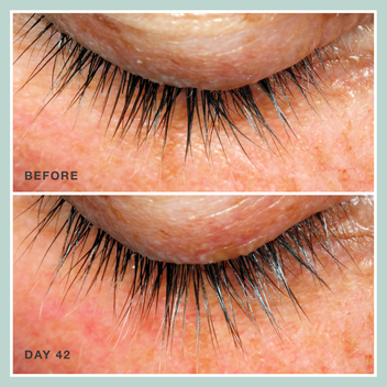 Before & After Results | See the Difference | Contours Rx