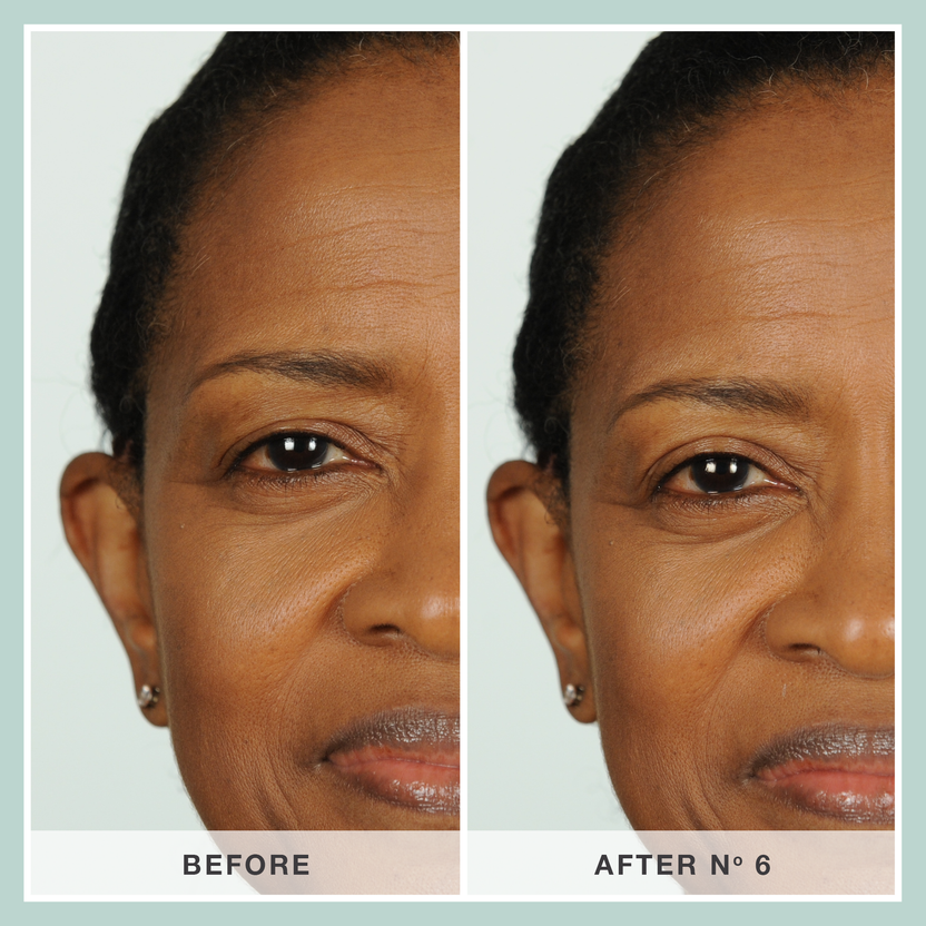 Before & After Results | See the Difference | Contours Rx