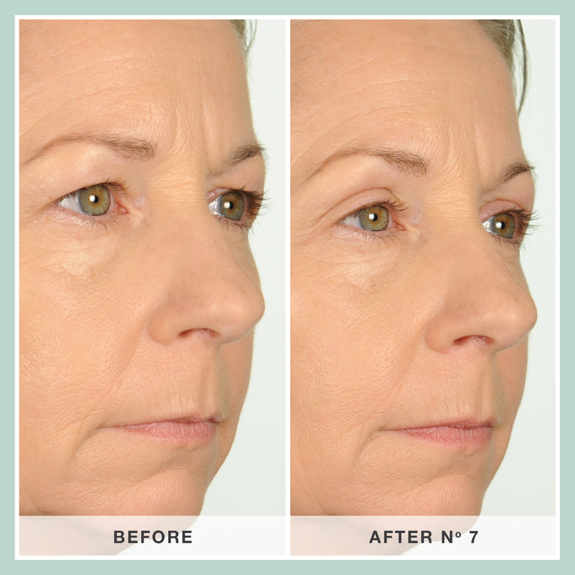 Before & After Results | See the Difference | Contours Rx