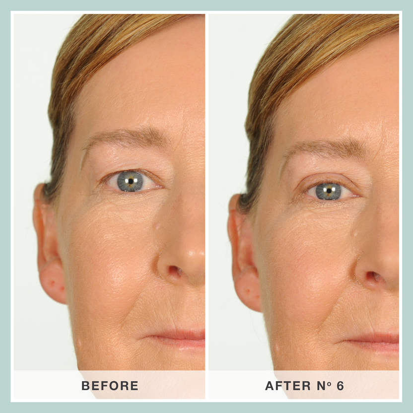 Before & After Results | See the Difference | Contours Rx