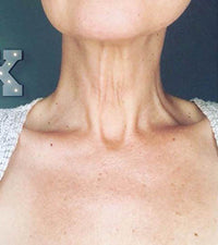 WHY CHOOSE CONTOURS RX? – Contours Rx