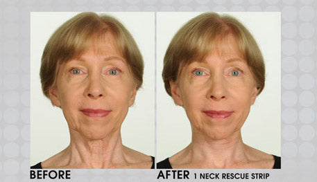 Before & After – Contours Rx