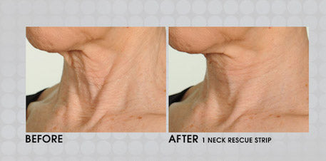 Before & After – Contours Rx